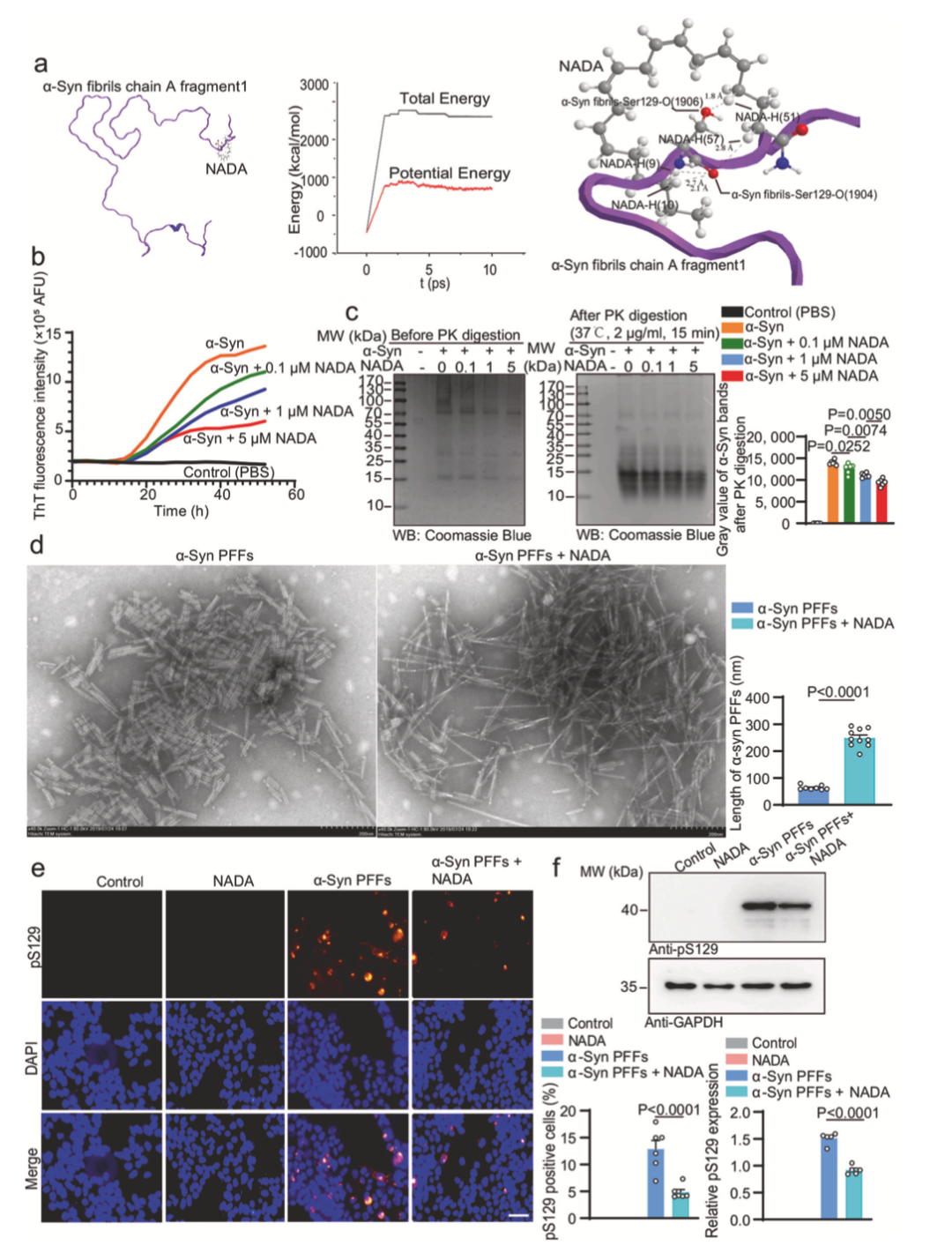 Cell Death Differ｜武汉大学张振涛团队揭示PM20D1-NADA通路对多巴胺能神经元 - 好大夫在线