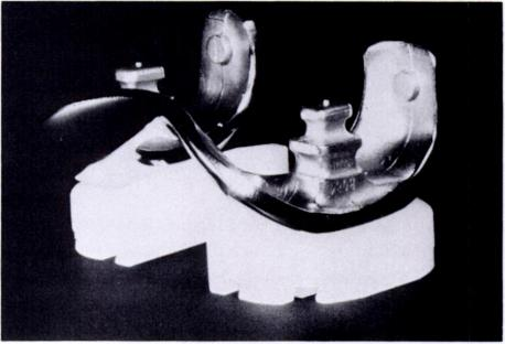 HSS膝关节评分标准_四种膝关节置换假体的比较_膝关节置换术_膝关节置换术治疗介绍 - 好大夫在线