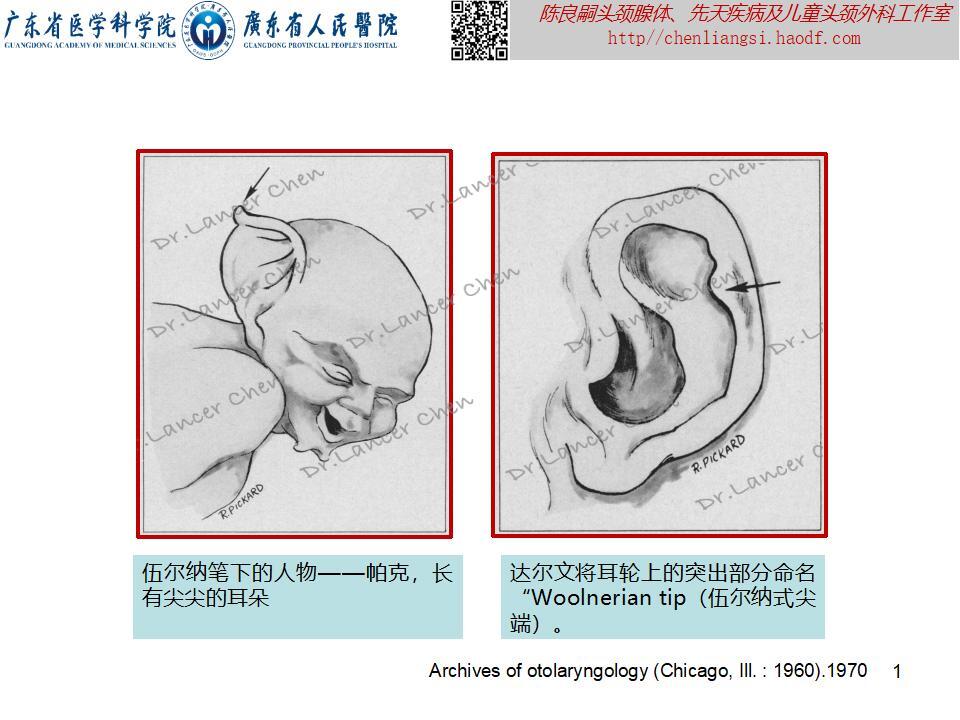 医学科普——达尔文结节：一种独特的耳廓先天畸形_耳部整形_耳部整形治疗介绍 - 好大夫在线