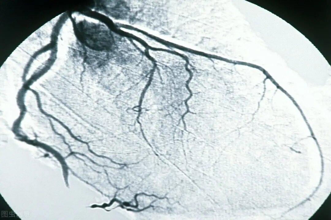 CT、CTA、DSA、MRI、MRA根据病情选择诊断_放射诊断_放射诊断介绍 - 好大夫在线