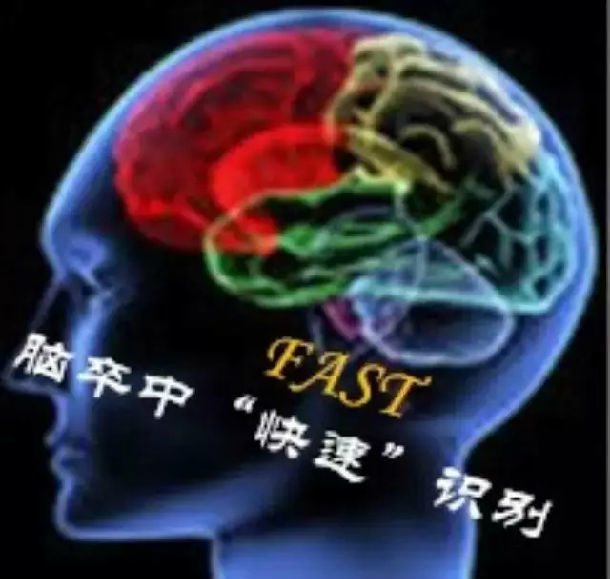 脑卒中的FAST（快速）识别法 - 好大夫在线