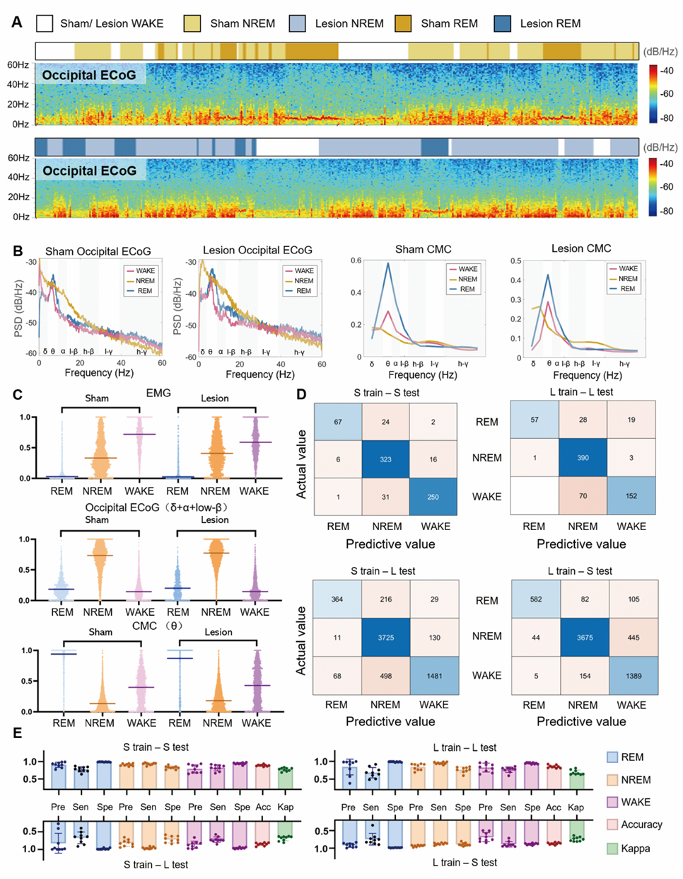 CNS | 山东第一医科大学辛涛、苏斐教授团队提出基于多特征融合的睡眠-觉醒自动分类和帕金森病识别的_帕金森_帕金森检查 - 好大夫在线