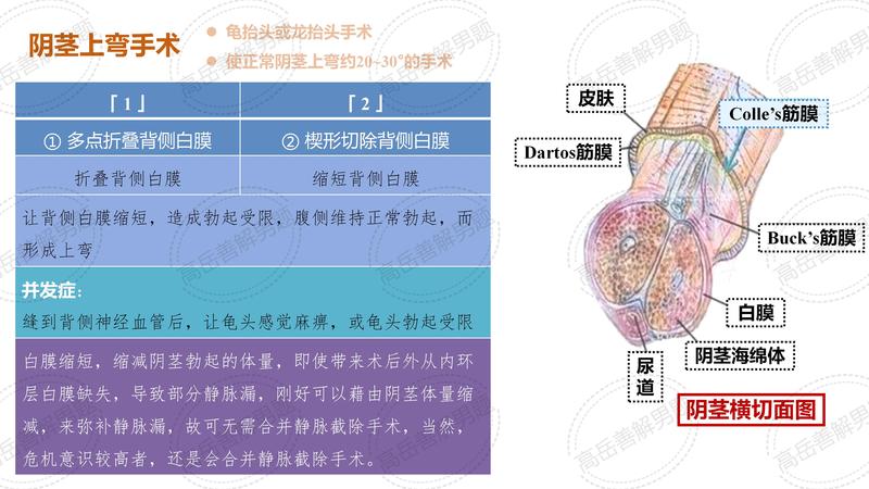 【阴茎弯曲：认识】龟头上翘——阴茎上弯是最优配置还是疾病？男性生殖器畸形男性生殖器畸形治疗方式 好大夫在线
